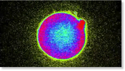 Scientists discover existence of zinc "sparks" at moment of human ...