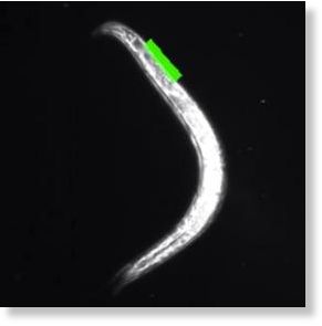 Single Worm Neurons Remotely Controlled with Lasers — Science ...