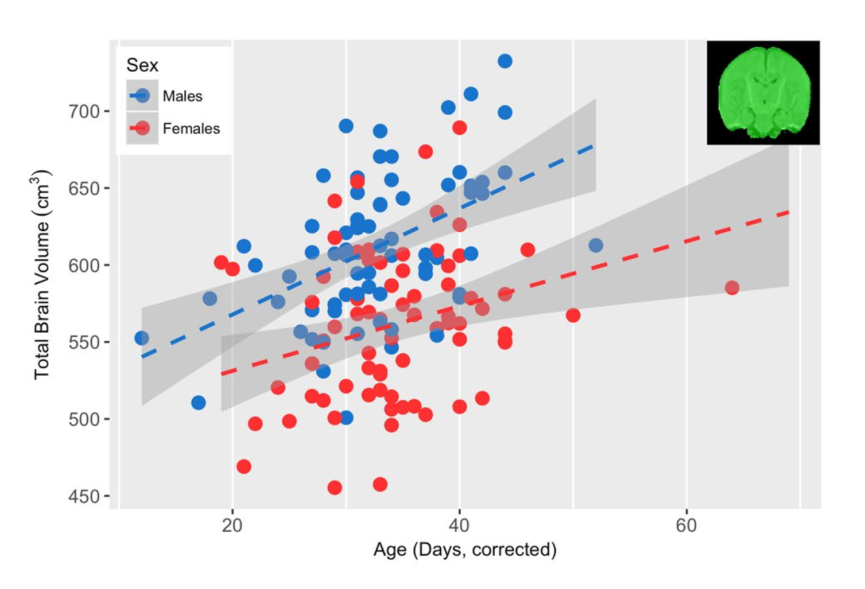 Sex Differences In Brain Structure Obvious Early In Development
