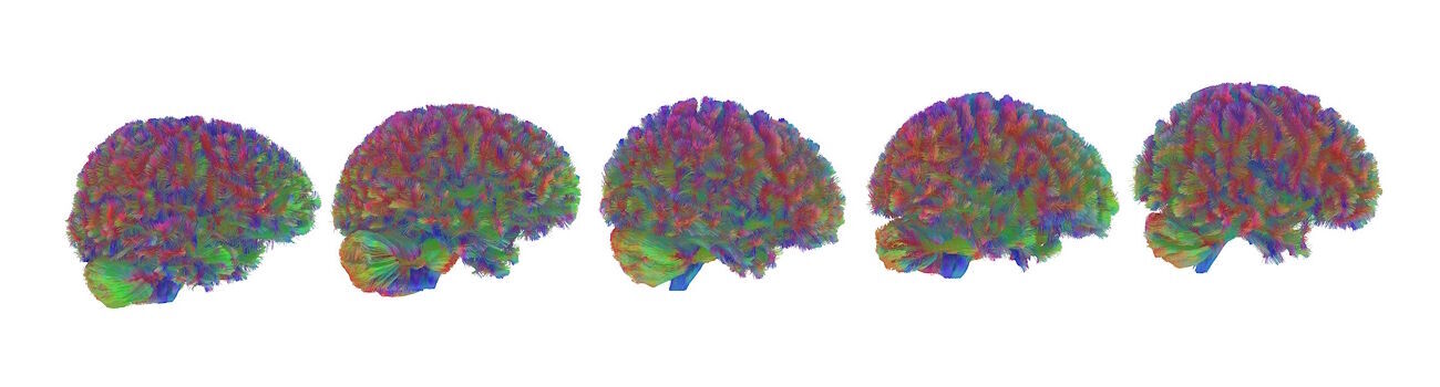 Scientists identify five ages of the human brain over a lifetime ...