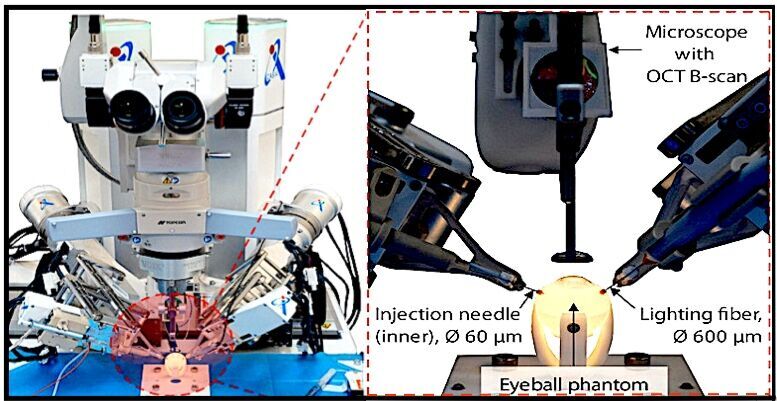 Chinese researchers develop eye surgery robot — Science & Technology ...